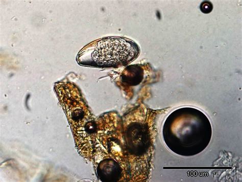 Egg Of Passalurus Ambiguus Flotation Method Download Scientific Diagram