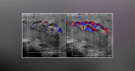 Pain And Swelling During Sexual Intercourse Diagnose This Babe Man