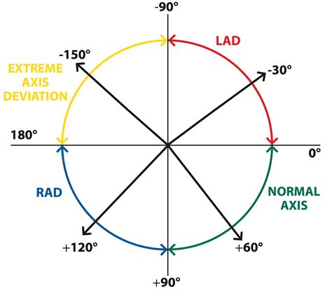 The Basics Of Ecg Interpretation Part 2 Rate Rhythm And Axis Medical Exam Prep