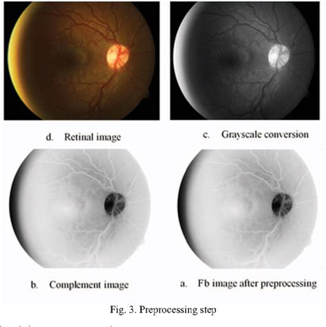 Figure 1 From Automated Microaneurysms Detection In Fundus Images Using
