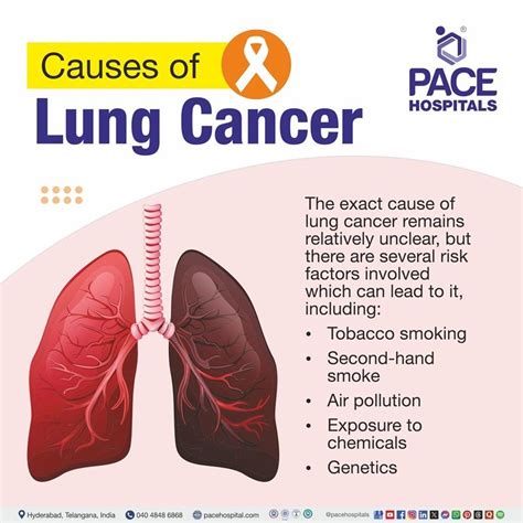 Lung Cancer Causes Symptoms Stages Treatment Prevention