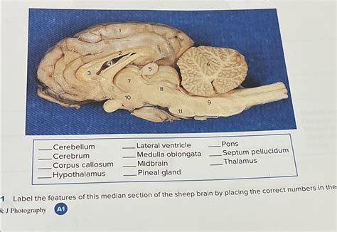 Solved Table Table Cerebellum Cerebrum Corpus