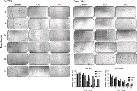 In Vitro Scratch Assay Notes Cell Migration Evaluated On Bu25tk And