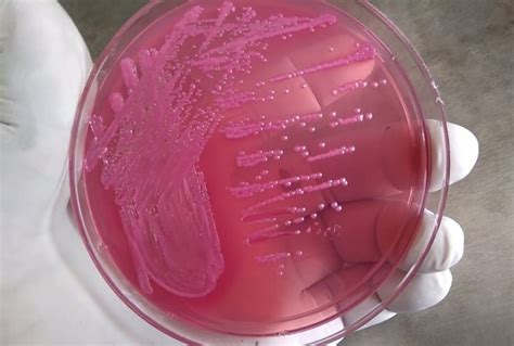 Enterobacteriaceae Introduction And Phenotypic Features