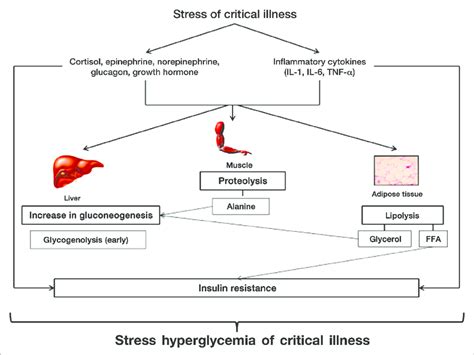 Pathophysiology Of Stress Hyperglycemia In Critical Illness Download
