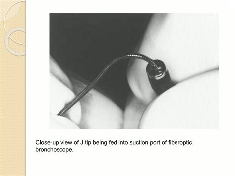 Retrograde Intubation Pptx