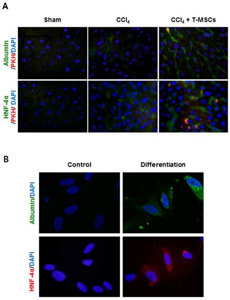 Expression Of Hepatocyte Markers In Differentiated T Mscs