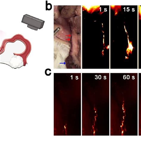 A Schematic Illustration Of Fallopian Tube Nir Ii Imaging Together Download Scientific
