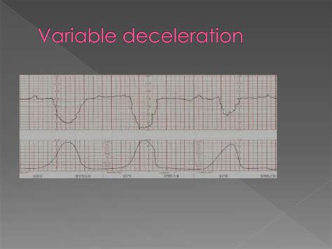 Ppt Labor And The Birth Process Powerpoint Presentation Free