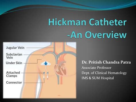 Hickman Catheter An Overview Details About Hickman Insertion Care
