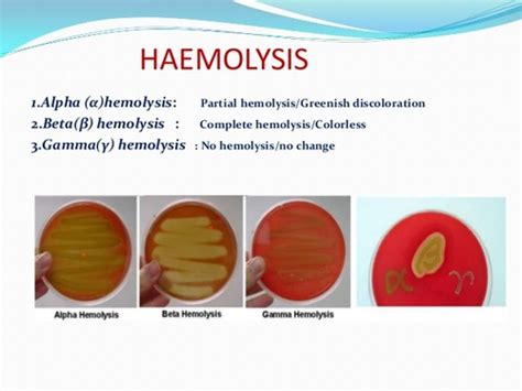 Alpha Hemolysis Vs Beta Hemolysis