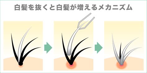 アンダーヘア陰毛の白髪はいつごろから生える？原因と対策方法