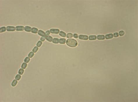 Anabaena 100x
