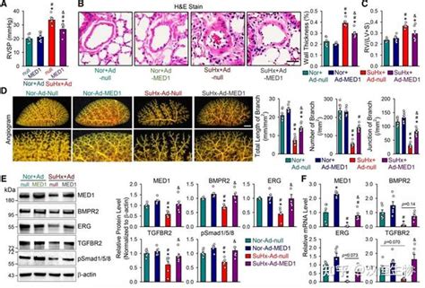 Circulation Research 肺动脉高压内皮细胞的调控新机制 知乎