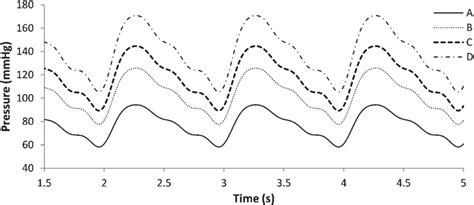 Inlet Pressure For Different Flow Conditions Download Scientific Diagram