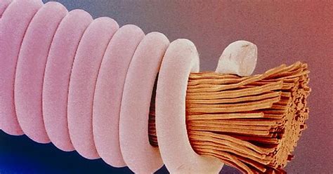 Microscopic Picture Of A Guitar String Imgur