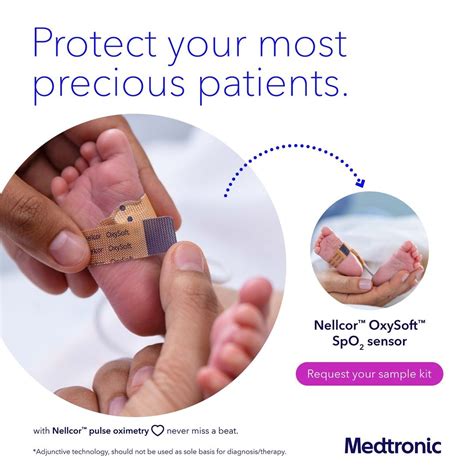 Medtronic Acute Care And Monitoring On Linkedin I Have Read And Agree With The Terms And