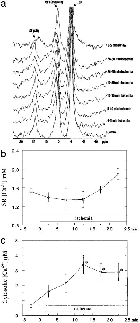 A 19 F Nmr Spectra Addition Of Spectra From 4 Hearts During Control Download Scientific