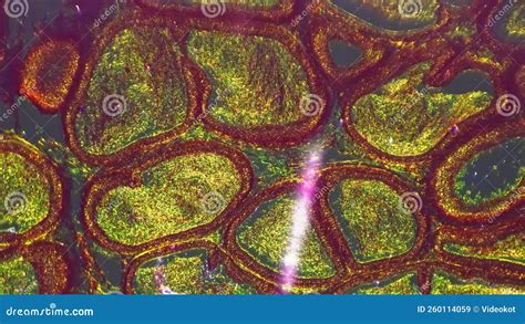 Microscopic Slide With Testis In Transversal Section Magnified In 100