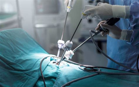 Laparoscopy Surgery Laparoscopic Surgeon In Sharjah Dubai