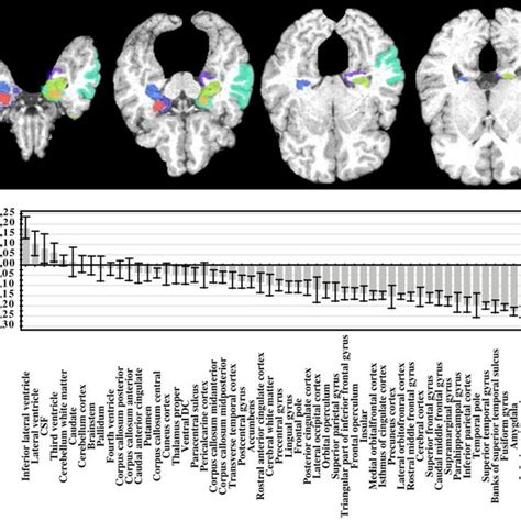 a using a svm multi kernel approach zhang et al zhang et al 2011