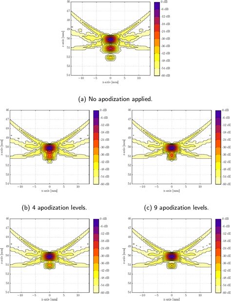 Figure 2 10 From Advanced 3 D Ultrasound Imaging 3 D Synthetic