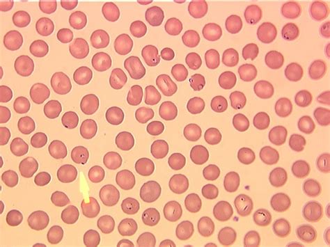 Microscopic Description Case