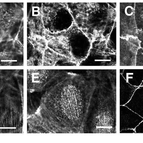 Organization Of The Actin Cytoskeleton And Cell Cell Contacts In