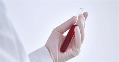 Blog Post I Unlocking Health Insights With Plasma Proteomics