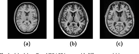 Figure From Unsupervised MR Harmonization By Learning Disentangled Representations Using
