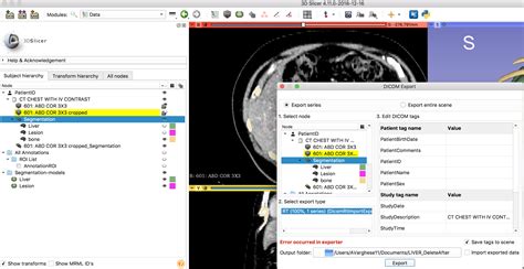 Exporting Dicom Directory After Segmenting Lesion Feature Requests