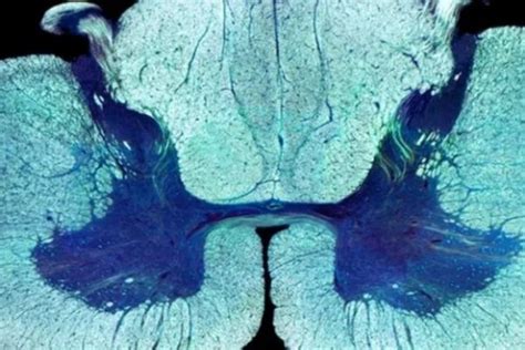 Nature重磅是什么让瘫痪者重新行走科学家有了新发现 36氪