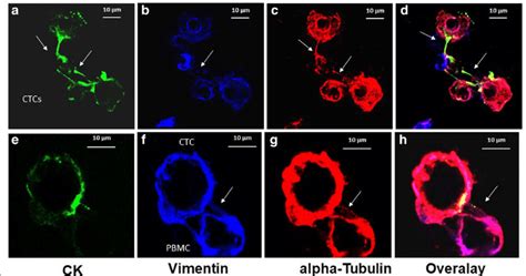 Expression Of Cytokeratin Ck Vimentin Vim And α Tubulin Tub In