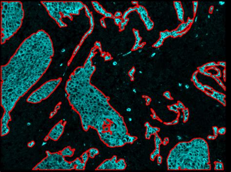 Guide Qupath Multiplex Analysis Workflow Detailed Pre 020 Release