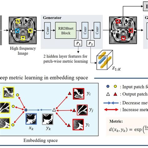 Proposed Deep Metric Learning For Low Dose Ct Denoising The Positive Download Scientific
