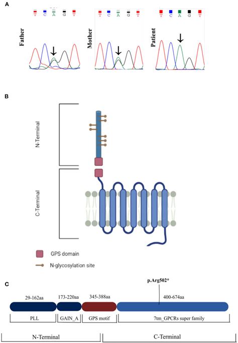 Case Report Diffuse Polymicrogyria Associated With A Novel Adgrg1