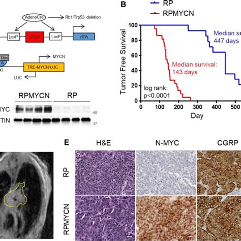Mycn Overexpression Promotes Sclc In Mouse Models A Schematic Of Download Scientific Diagram