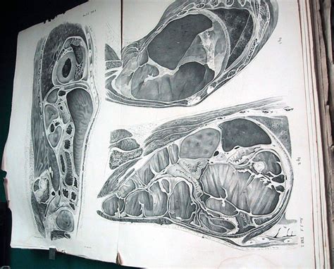 Атлас М І Пирогова Топографічна анатомія розпилів проведених у трьох напрямках через
