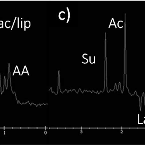 A Transverse Flair Image Shows The Location Of The Rectangular Voxel