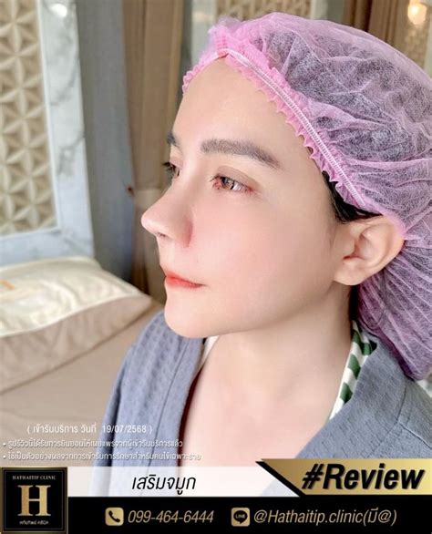 หทัยทิพย์ คลินิก พระราม2 ศัลยกรรมตกแต่งความงาม ขอแบบหน้าเปลี่ยนกลับบ้านไป ผู้จบไม่ได้เลย😂😍 ใคร