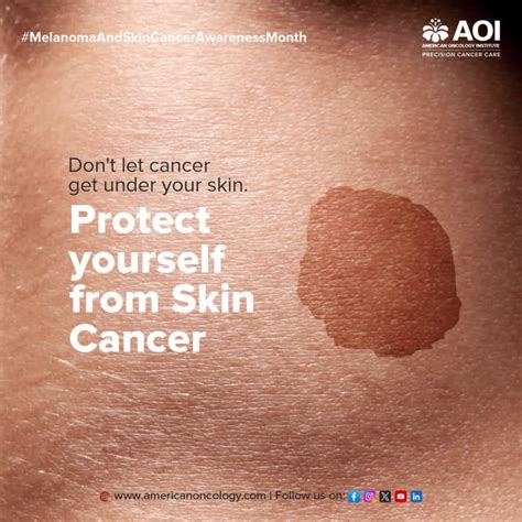 American Oncology Institute Precision Cancer Care On Linkedin Skin