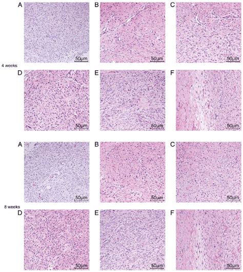 Hande Staining Indicated That Tp May Alleviate The Infiltration Of