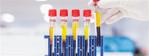 Minimal Residual Disease Detection Liquid Biopsy Nonacus