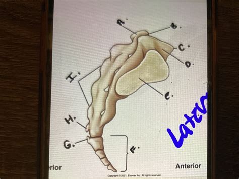 Lateral Sacrum Diagram Quizlet