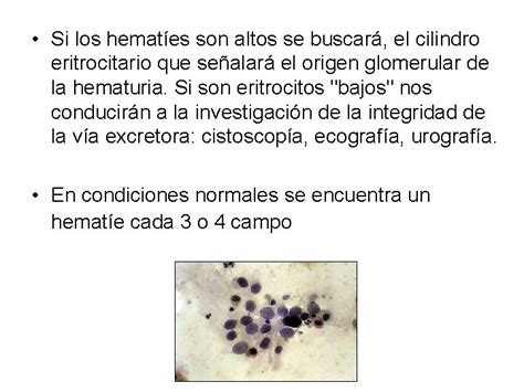Examen De Orina El Examen De Orina Efectuado