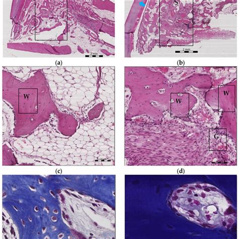 Effect Of Rutin Gel Treatment On Bone Formation Angiogenesis Bone