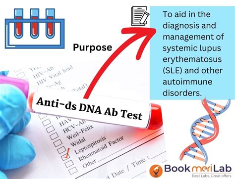 Anti Dsdna Test Get Price Purpose Results And Sample Report [2025]