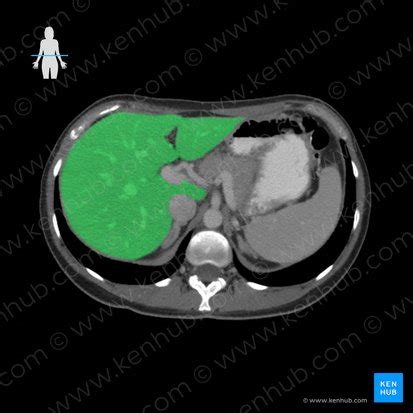 Tc Abdominal Cómo Interpretarla Kenhub
