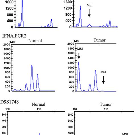 Representative Sample Of Microsatellite Instability Msi In Selected