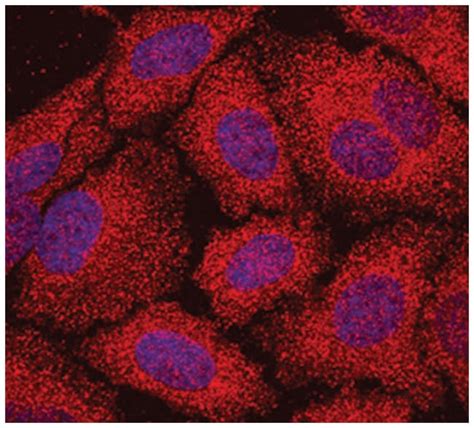 Human Beta Actin Antibody 100μg Unlabeledantibodies Monoclonal